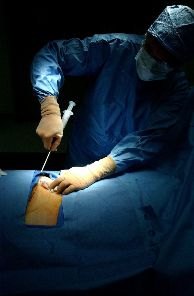 iv-therapy-safe-for-post-bone-marrow-transplant-cont-consult-dr-anderson